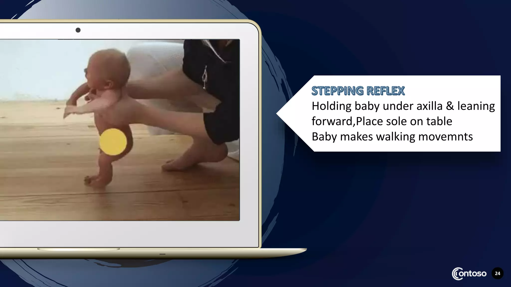 NEWBORN EXAMINATION-REFLEXES.pptx