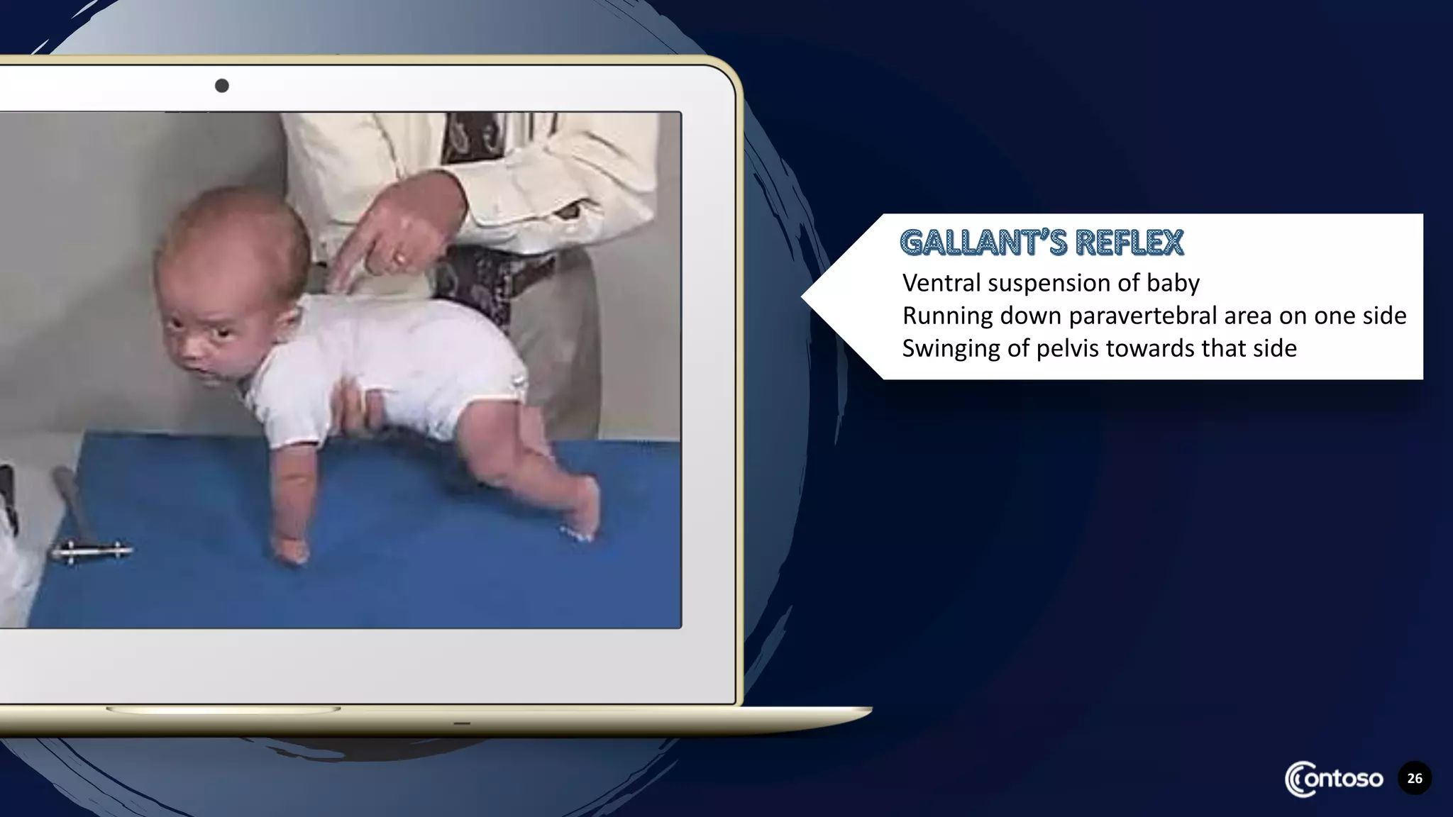 NEWBORN EXAMINATION-REFLEXES.pptx