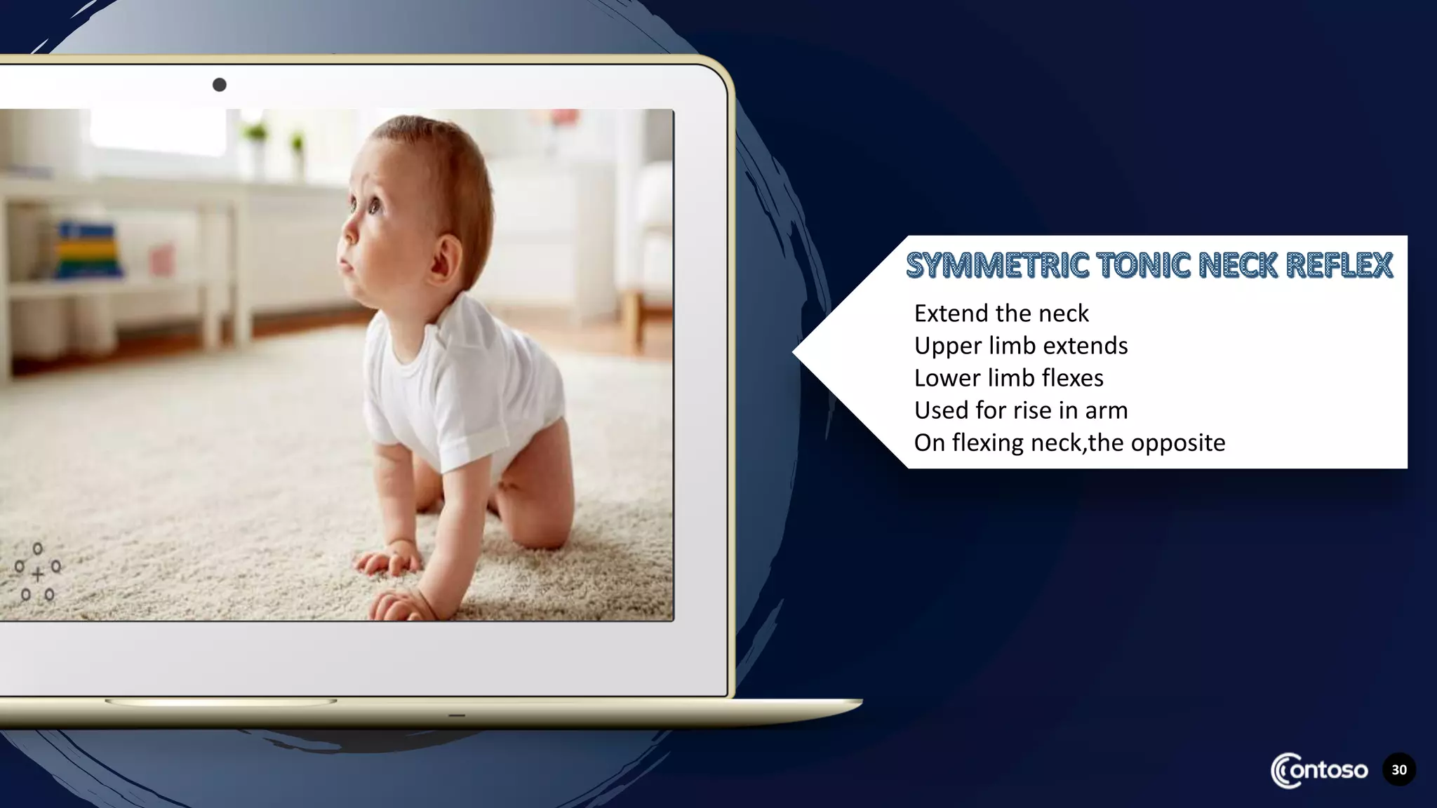 NEWBORN EXAMINATION-REFLEXES.pptx