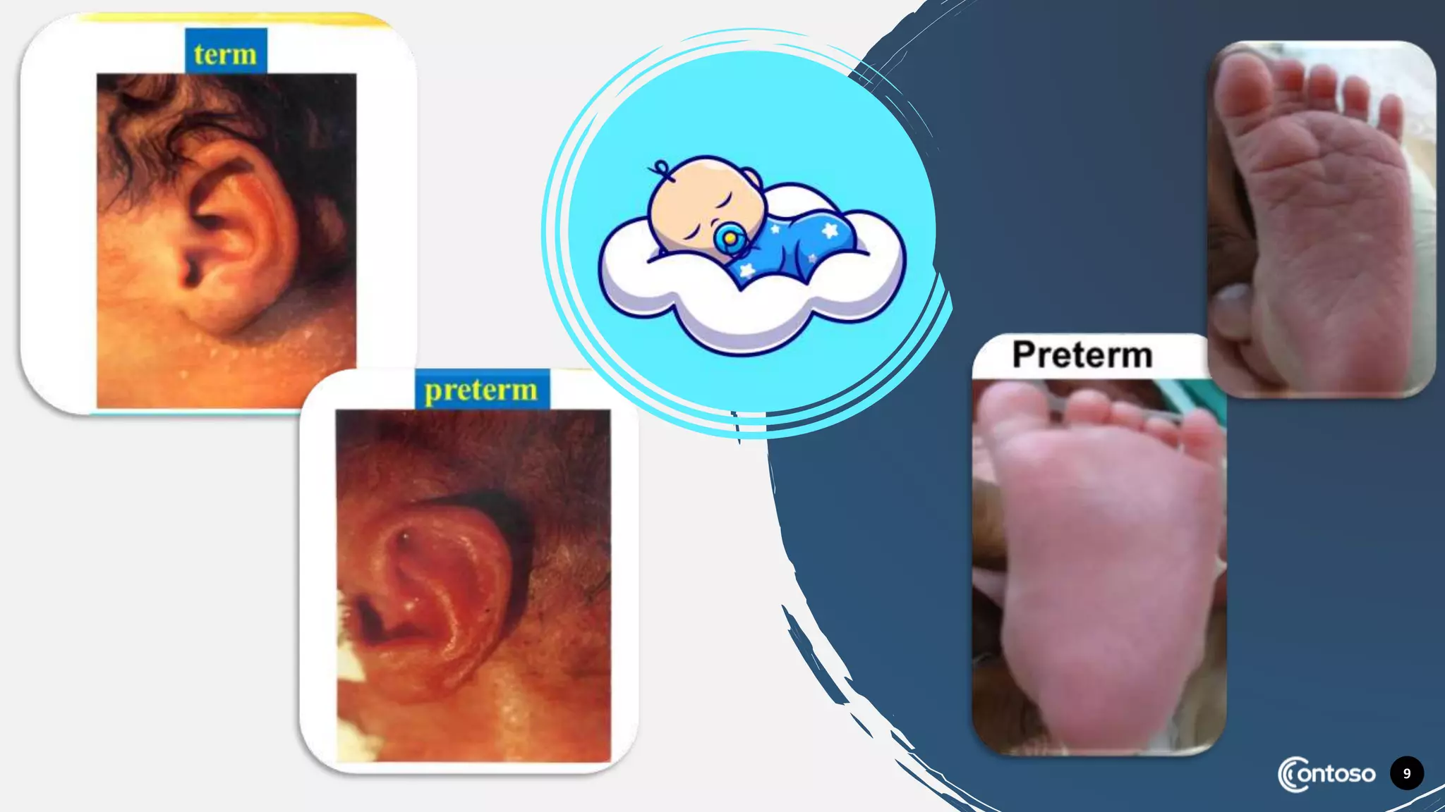 NEWBORN EXAMINATION-REFLEXES.pptx