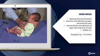 NEWBORN EXAMINATION-REFLEXES.pptx