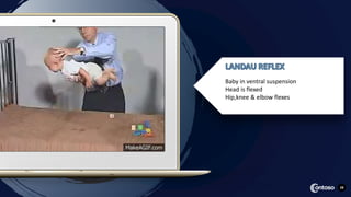 NEWBORN EXAMINATION-REFLEXES.pptx