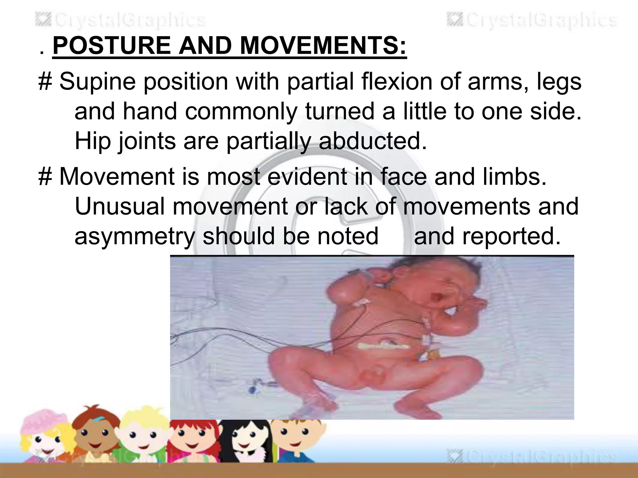 Newborn assessment | PPTX