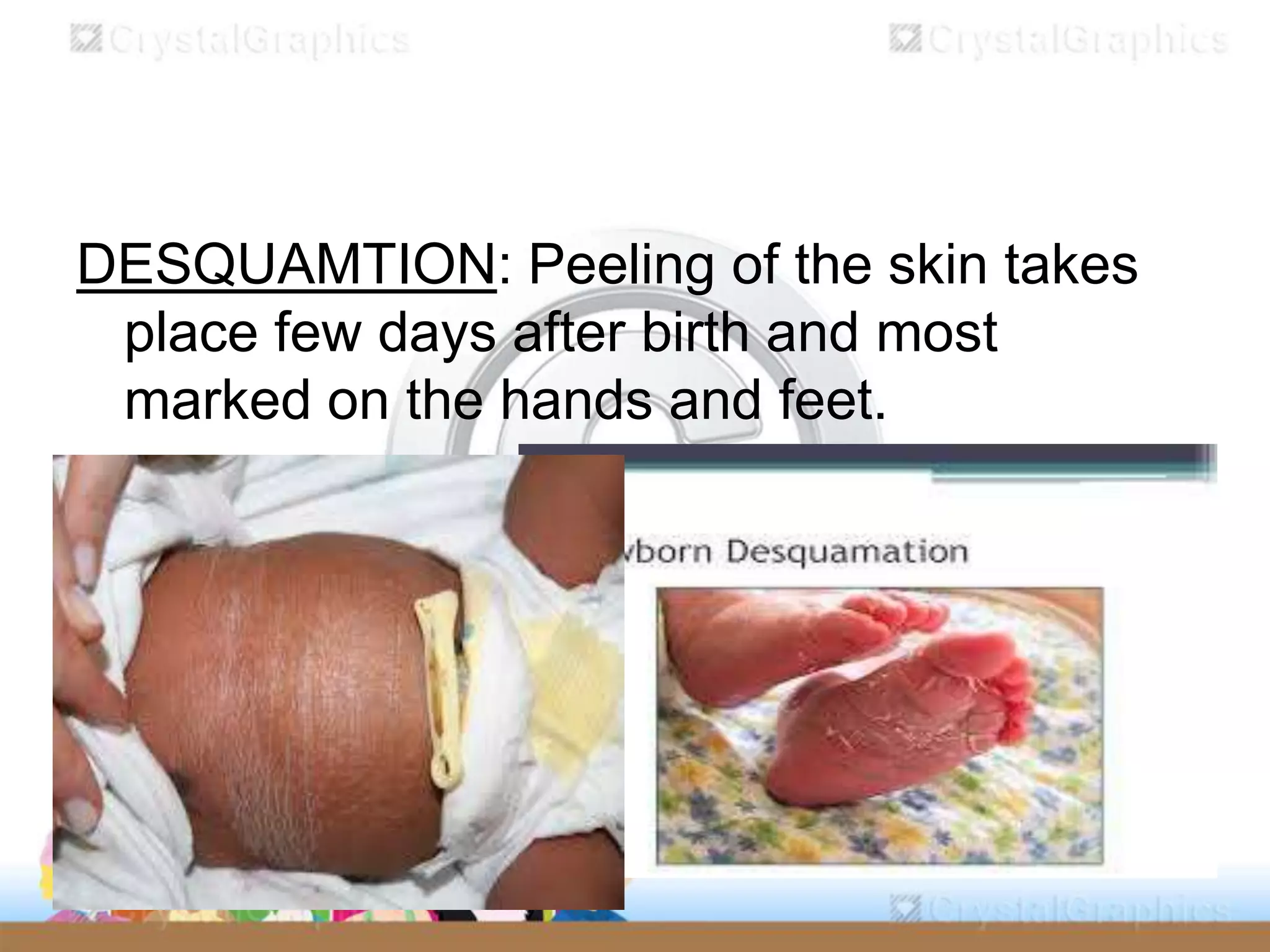 Newborn assessment | PPTX