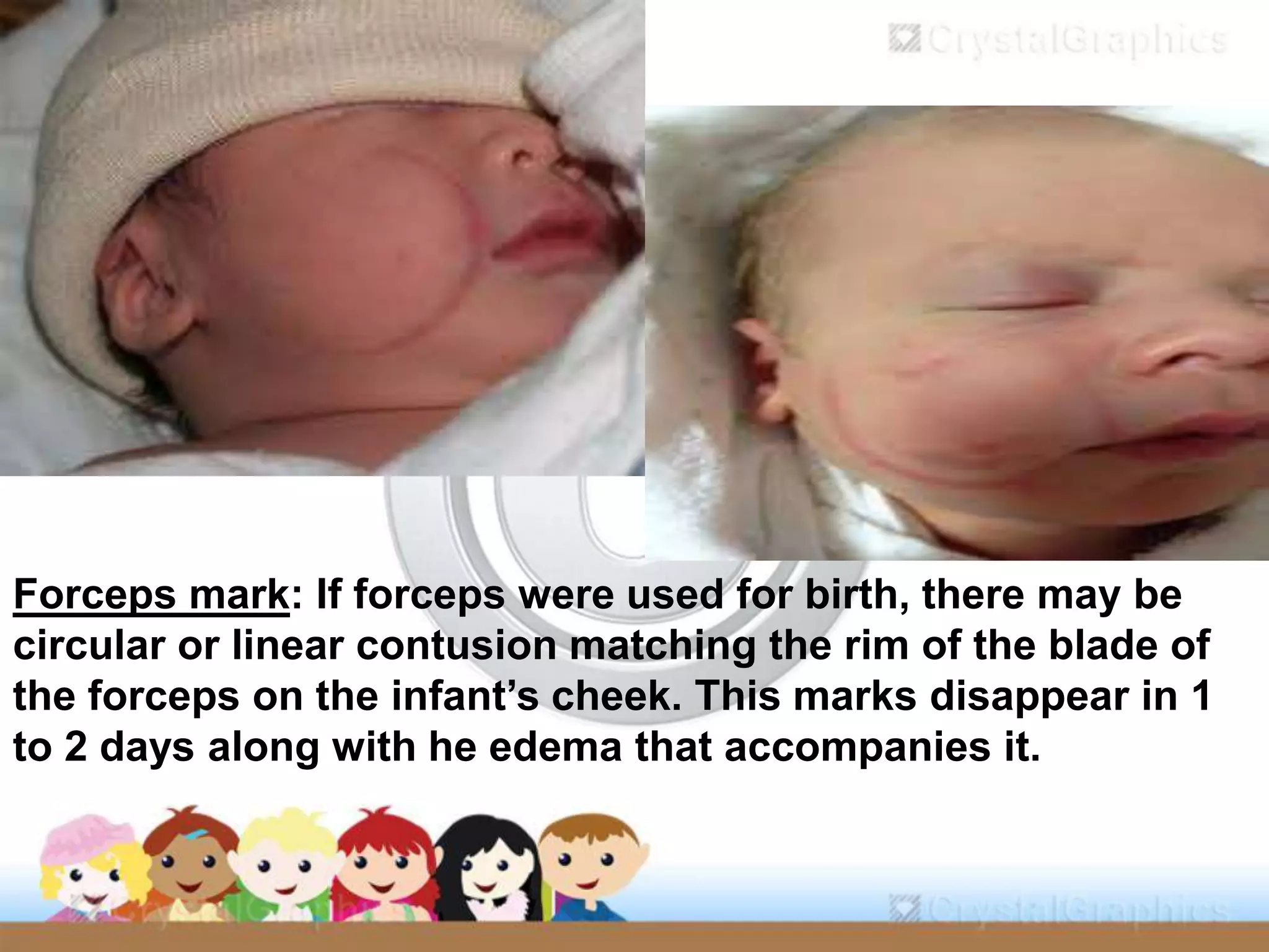 Newborn assessment | PPTX