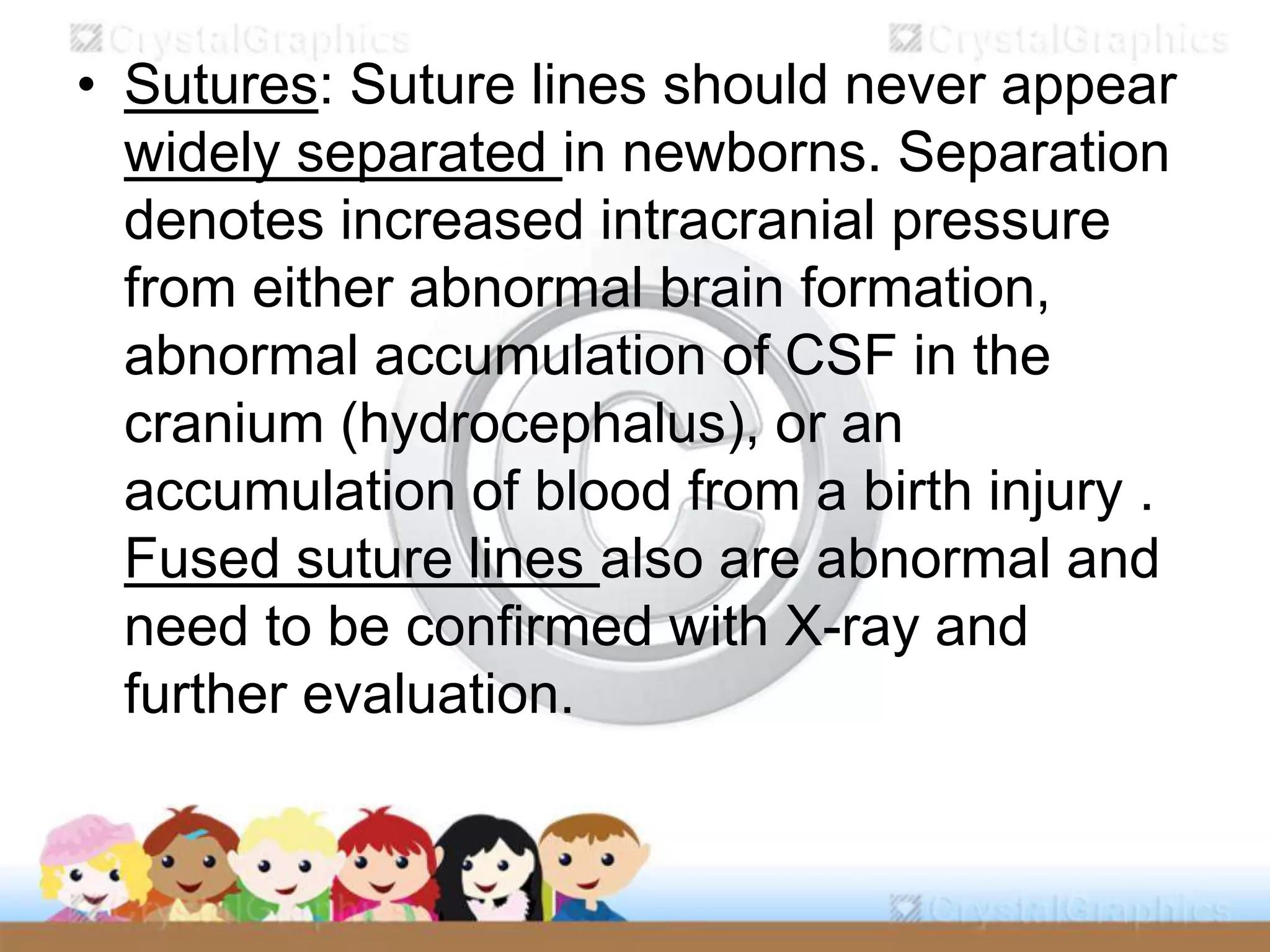 Newborn assessment | PPTX