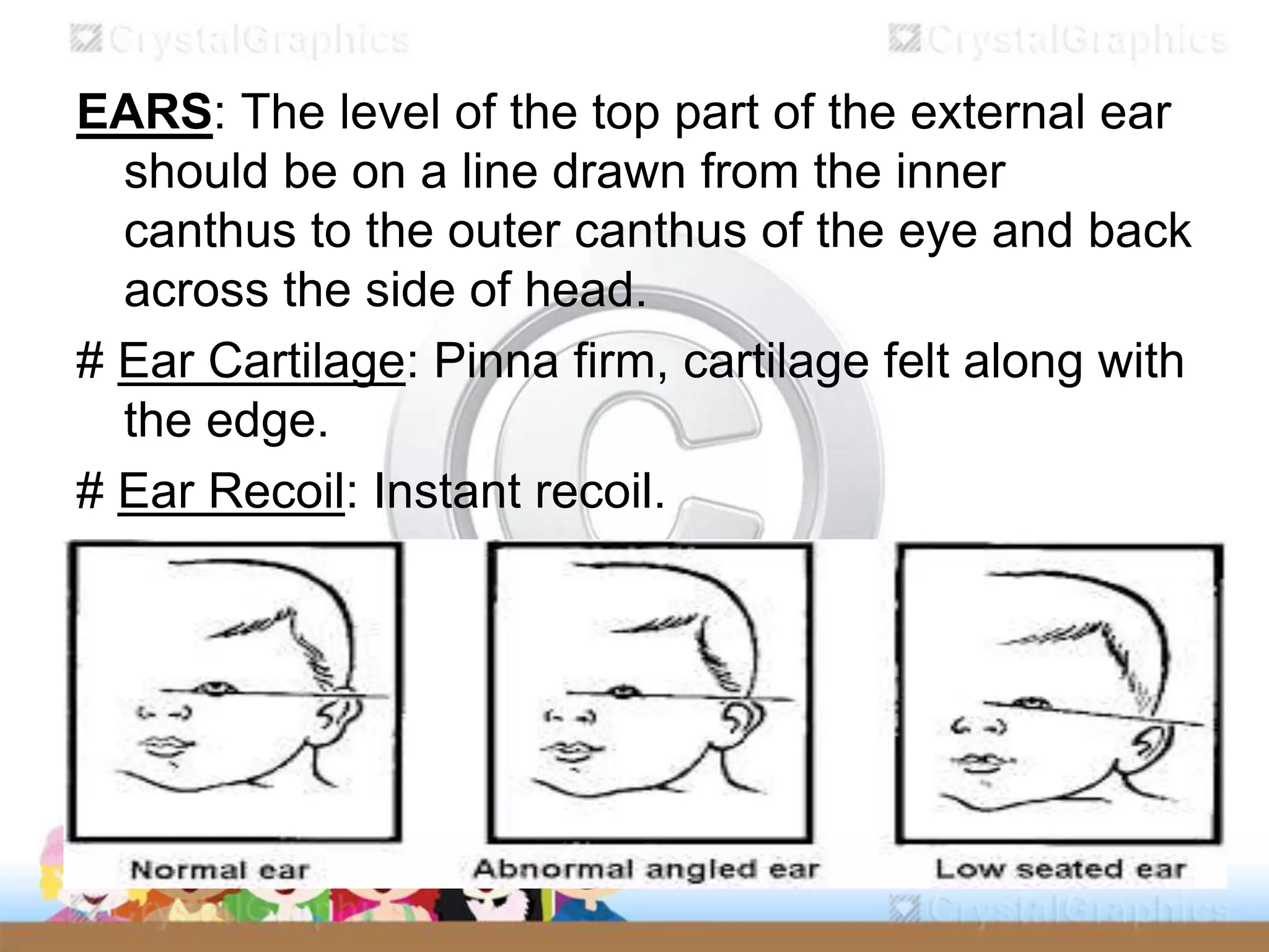 Newborn assessment | PPTX