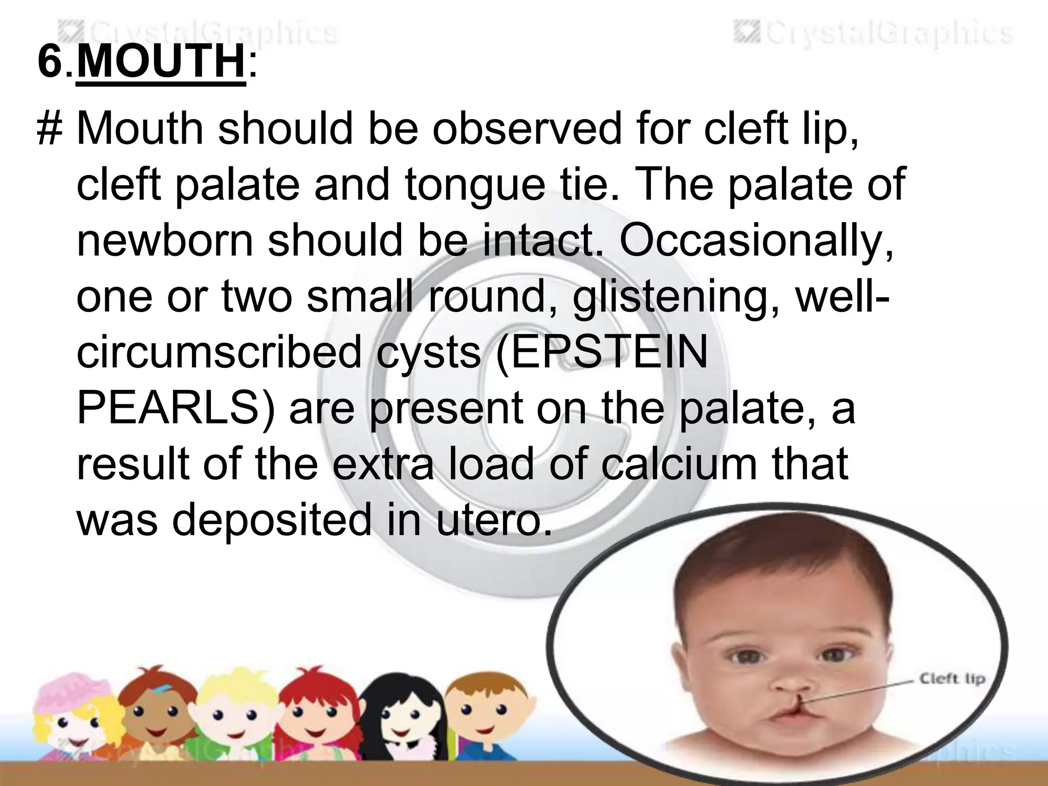 Newborn assessment | PPTX