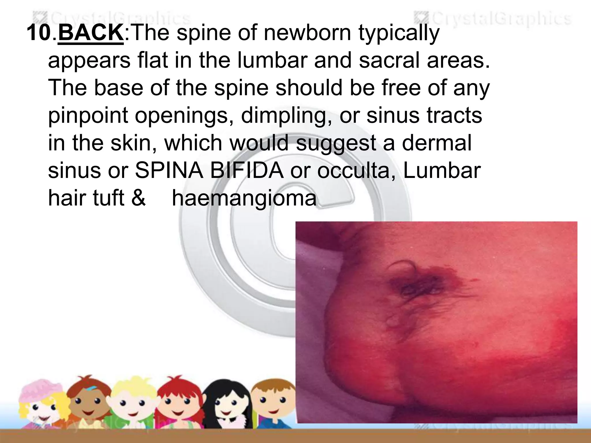 Newborn assessment | PPTX