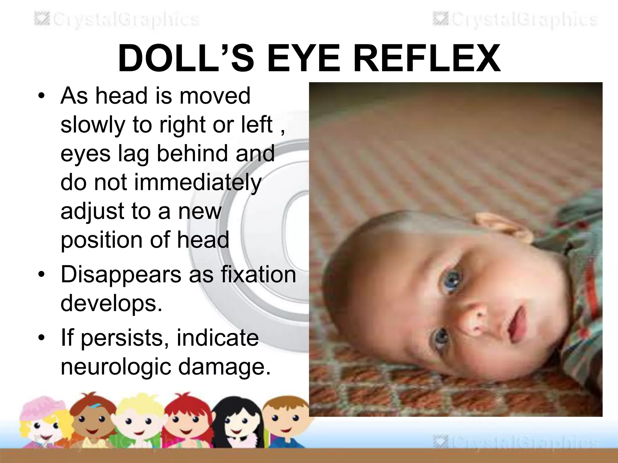 Newborn assessment | PPTX