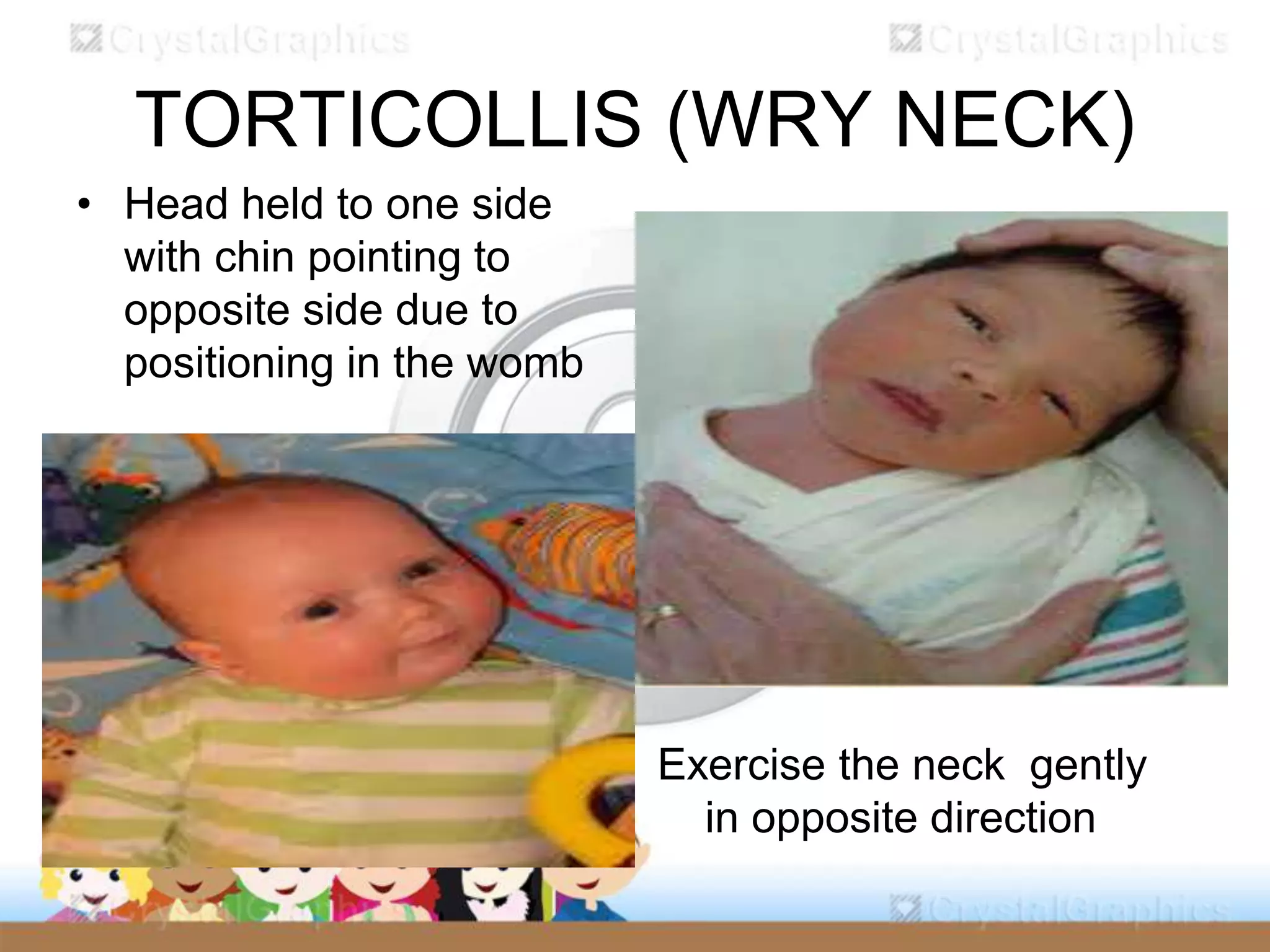 Newborn assessment | PPTX