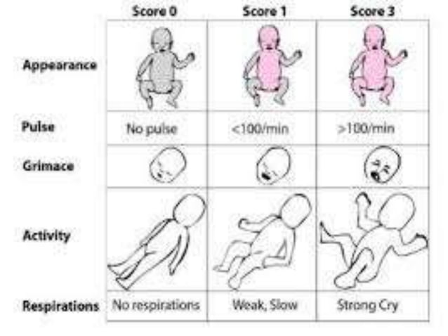Newborn assessment | PPTX