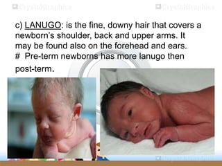 Newborn assessment | PPTX