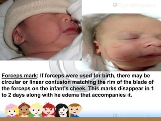 Newborn assessment | PPTX