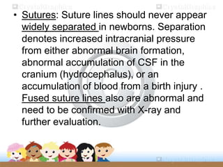 Newborn assessment | PPTX