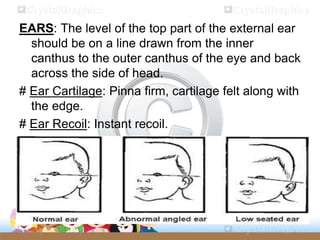 Newborn assessment | PPTX