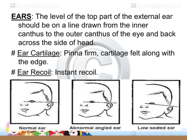 Newborn assessment | PPTX