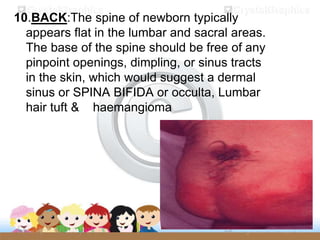 Newborn assessment | PPTX