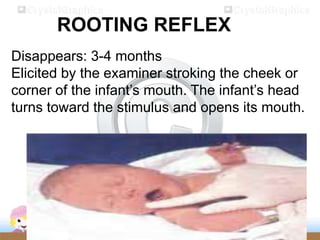 Newborn assessment | PPTX