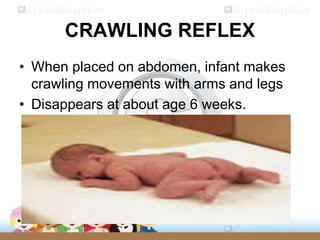 Newborn assessment | PPTX