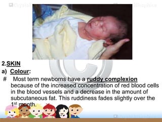 Ruddy Complexion Newborn