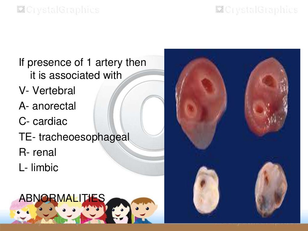 Newborn Assessment newborn-assessment
