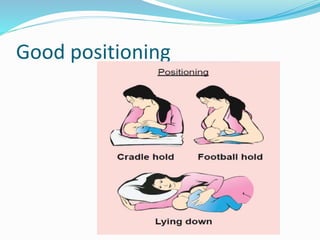 Newborn feeding | PPTX