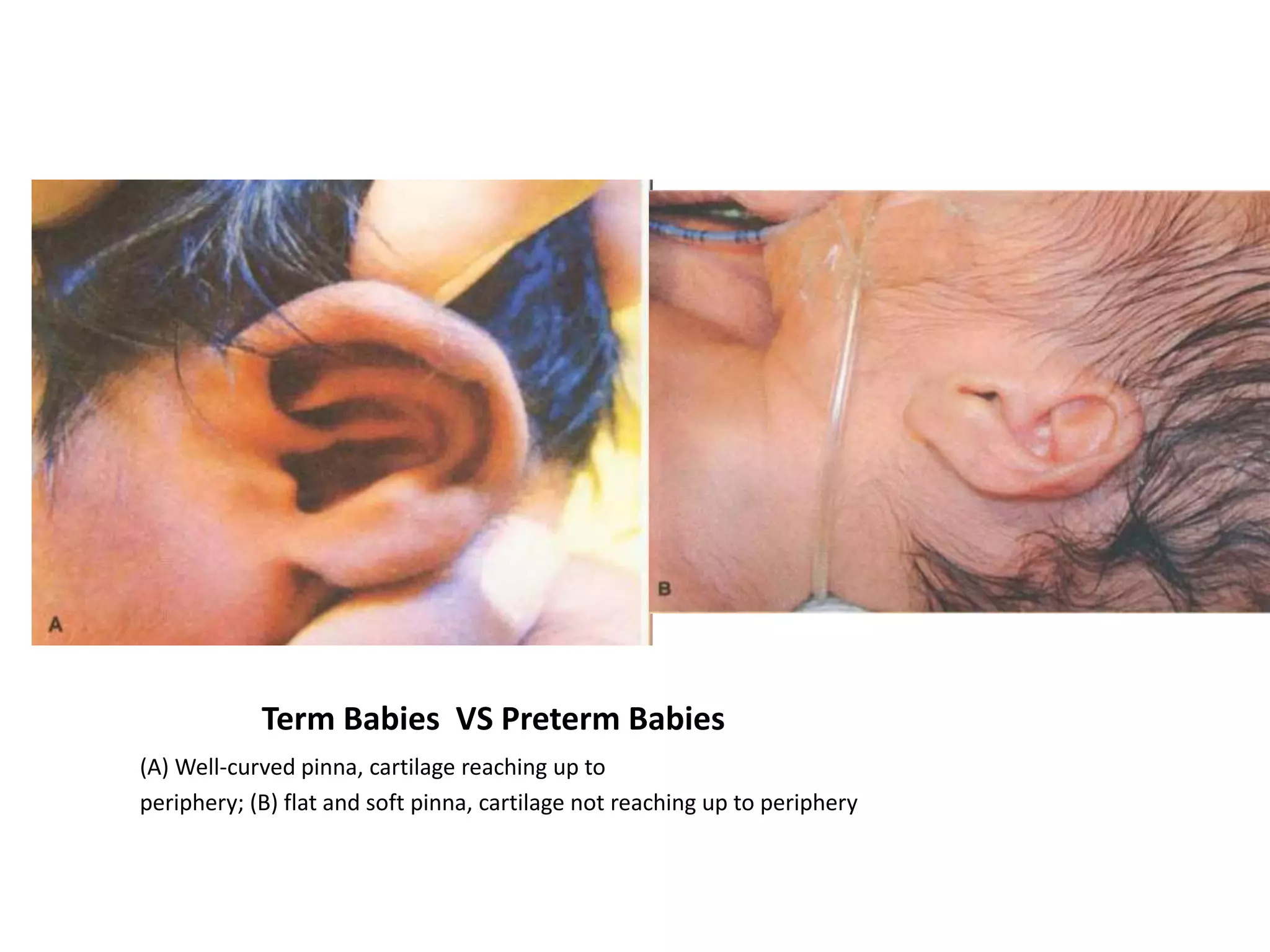 Newborn history and examination | PPTX