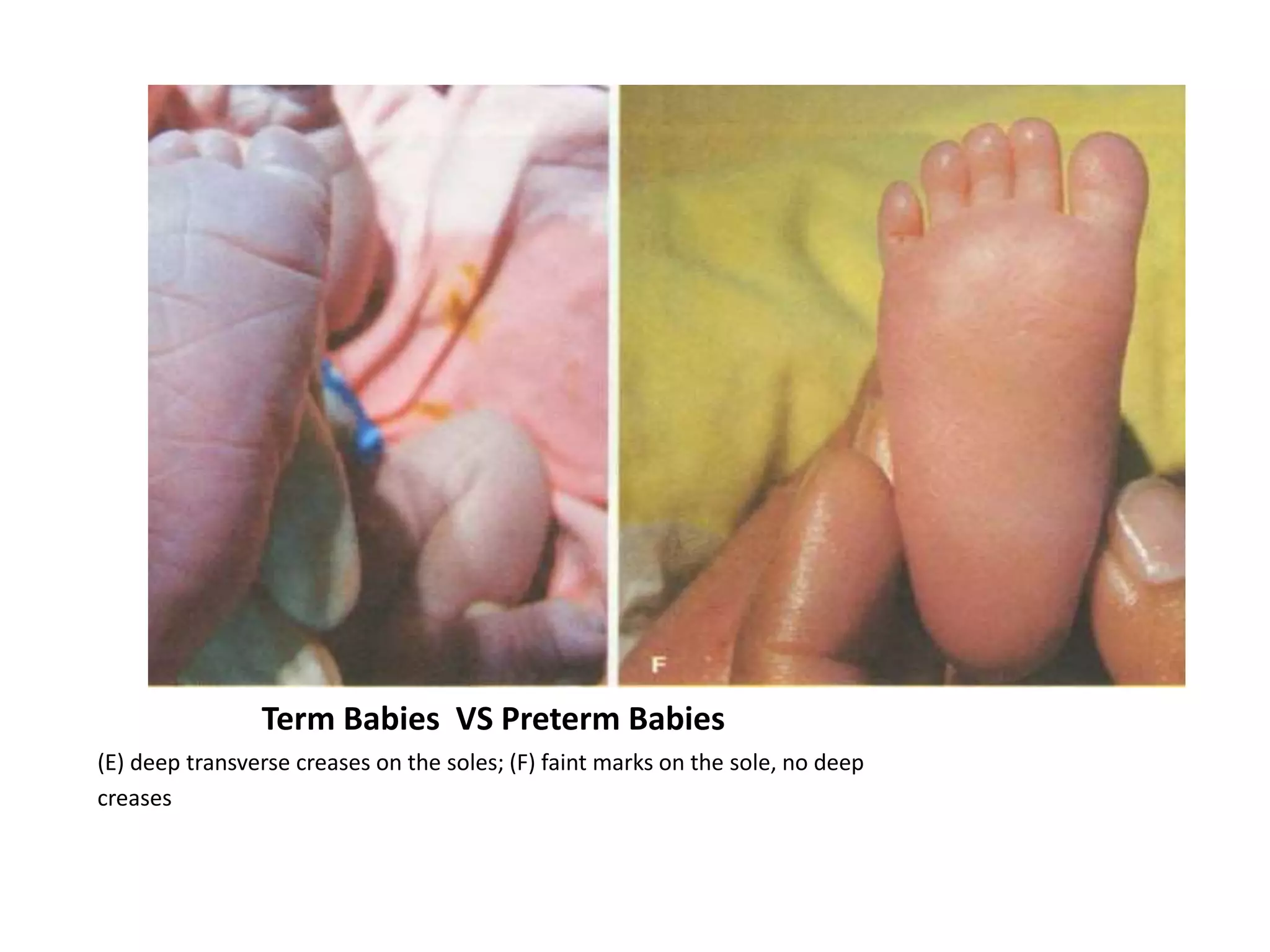 Newborn history and examination | PPTX