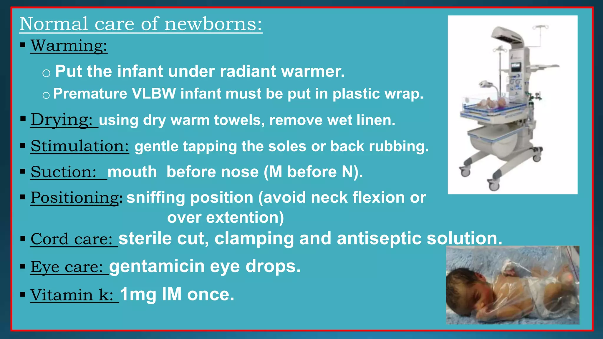 New born infant | PPT