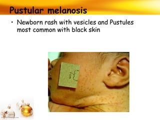 newborn physiology,characteristics classification.ppt