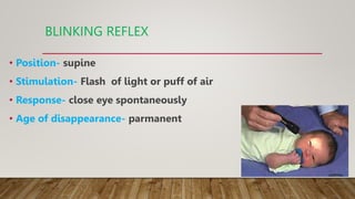 Newborn Reflex.pptx | Parenting Babies and Toddlers | Parenting