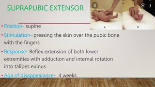 Newborn Reflex.pptx | Parenting Babies and Toddlers | Parenting