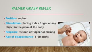 Newborn Reflex.pptx
