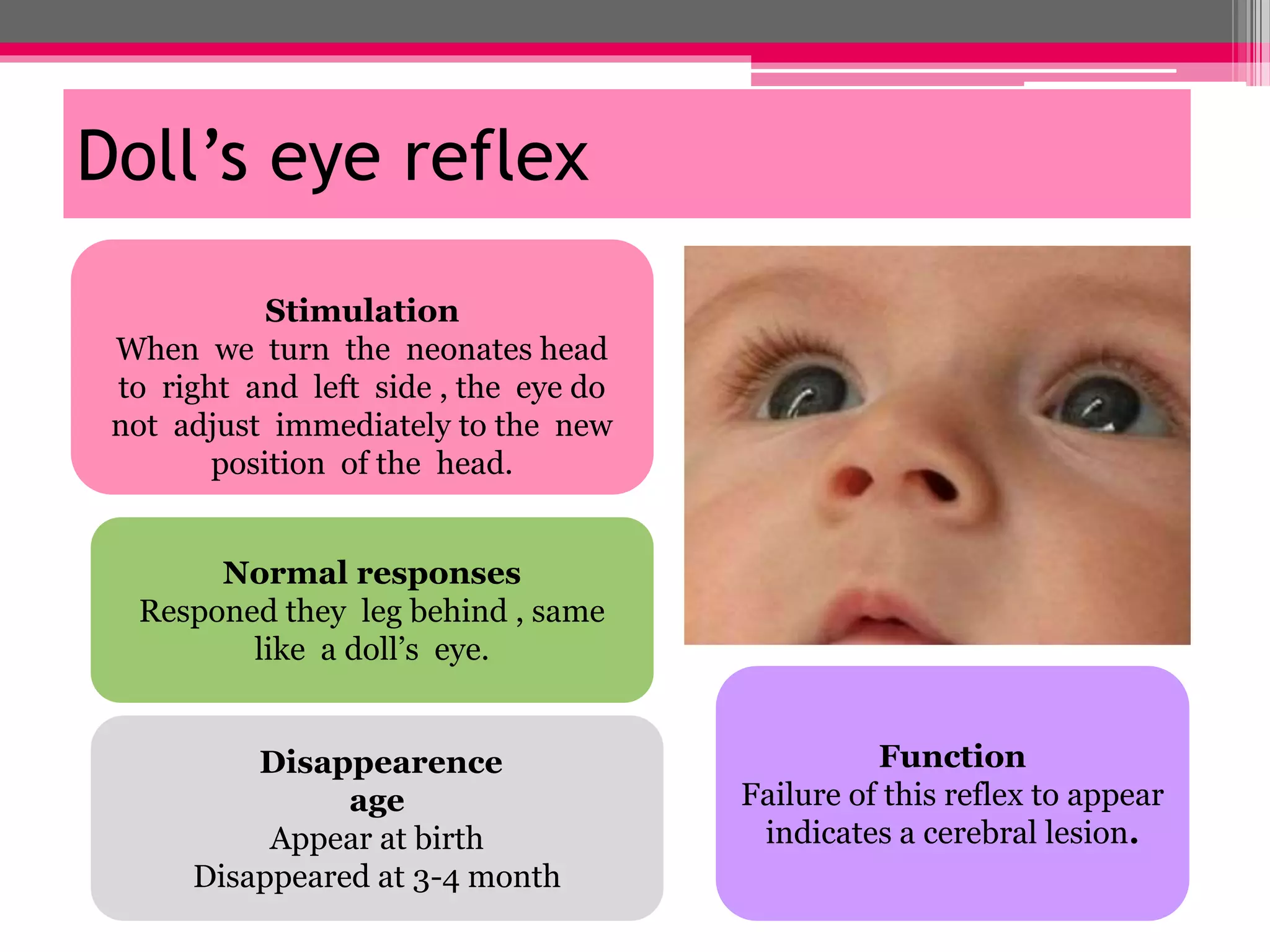 New born reflexes | PPTX