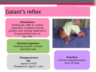 New born reflexes | PPTX