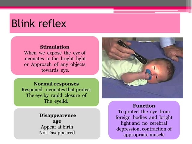 New born reflexes | PPTX | Parenting Babies and Toddlers | Parenting