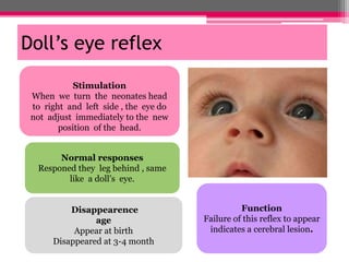 New born reflexes | PPTX