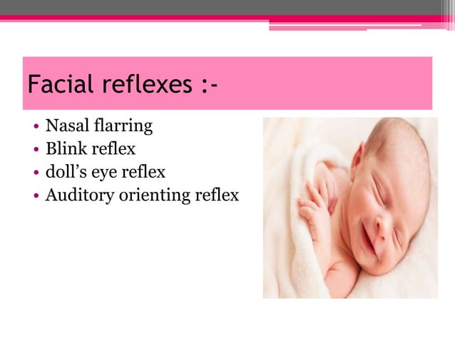 New born reflexes | PPTX | Parenting Babies and Toddlers | Parenting