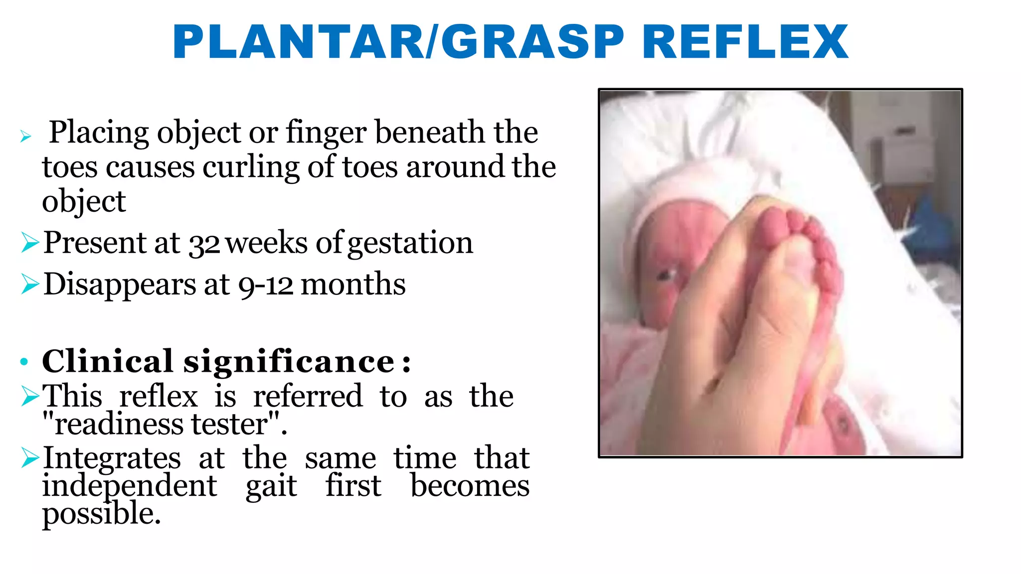 NEWBORN REFLEXES/ PRIMITIVE REFLEXES | PPTX