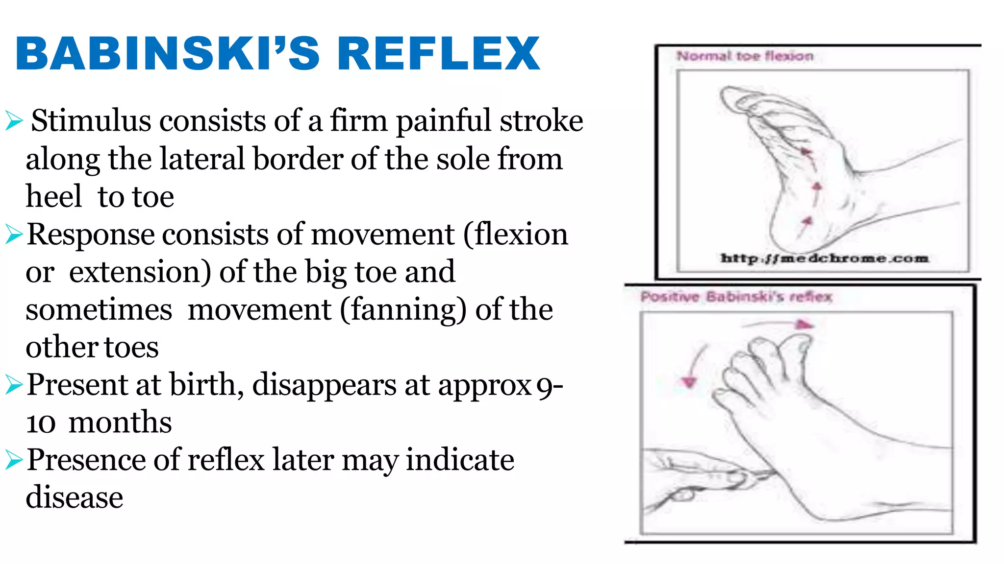 NEWBORN REFLEXES/ PRIMITIVE REFLEXES | PPTX