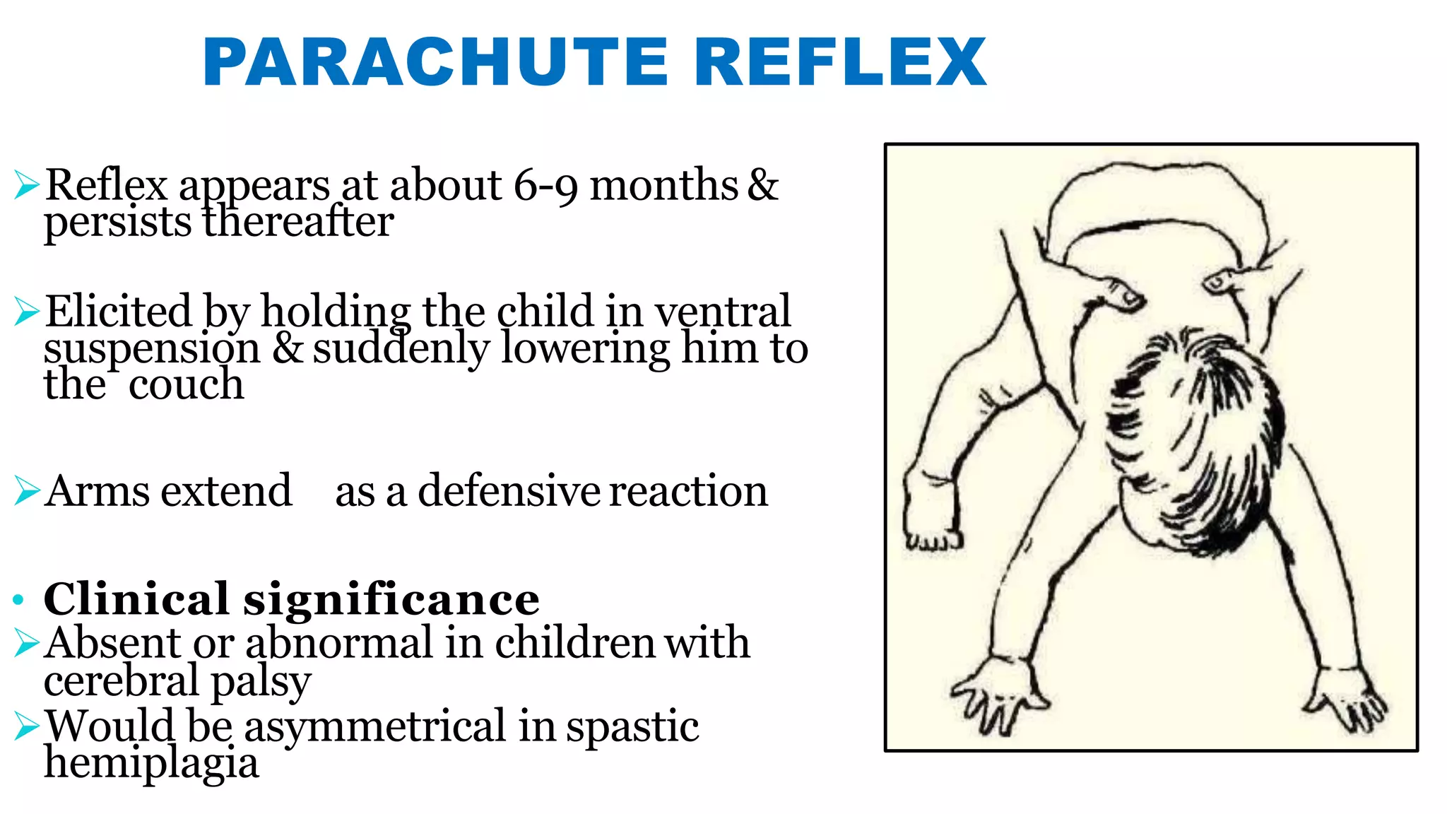 NEWBORN REFLEXES/ PRIMITIVE REFLEXES | PPTX