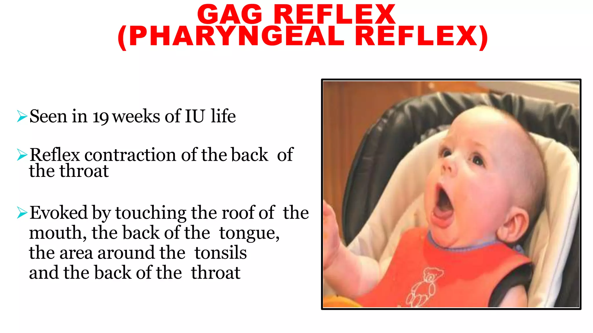 NEWBORN REFLEXES/ PRIMITIVE REFLEXES | PPTX