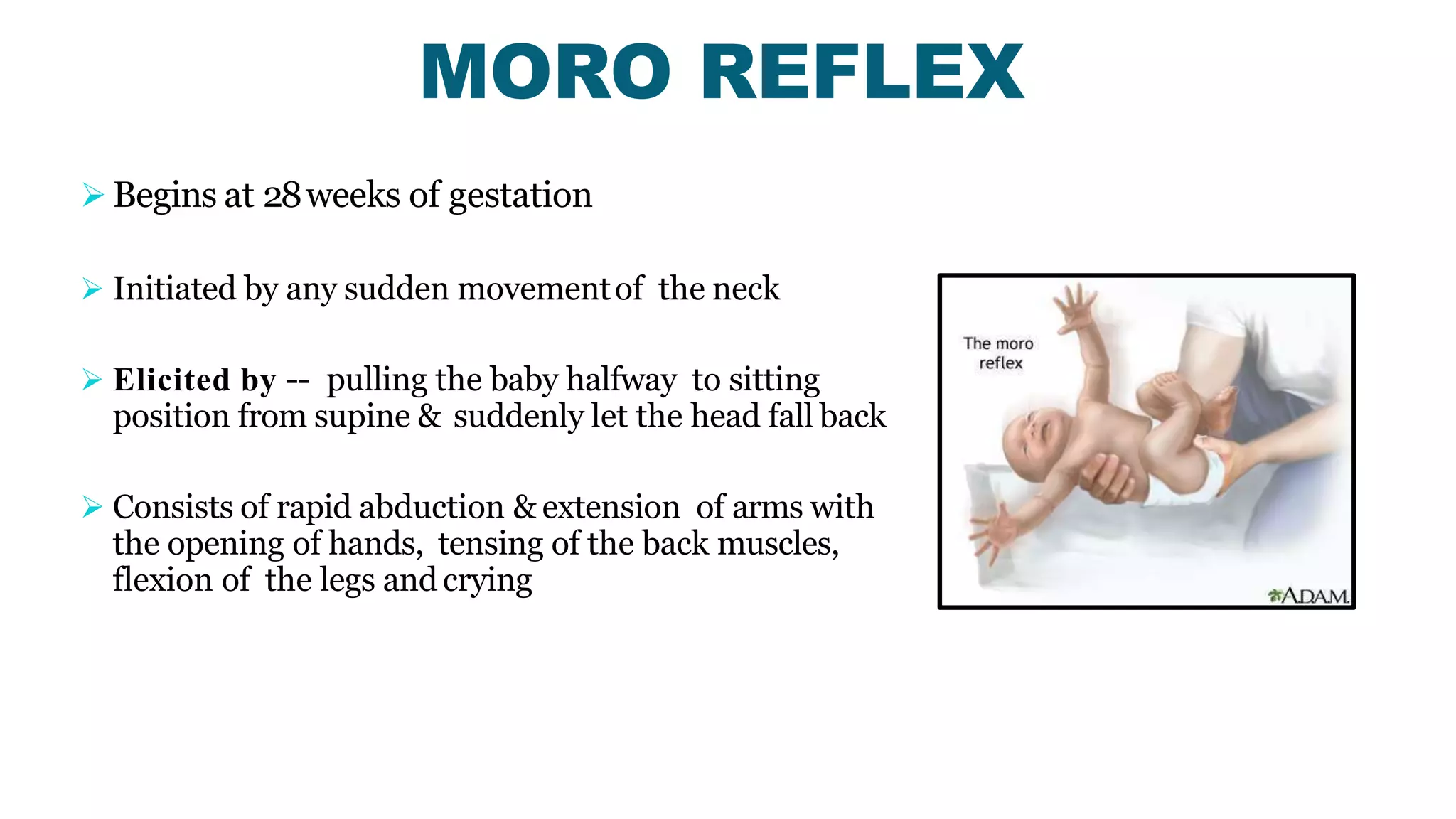NEWBORN REFLEXES/ PRIMITIVE REFLEXES | PPTX
