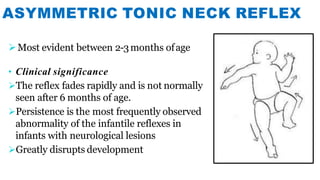 NEWBORN REFLEXES/ PRIMITIVE REFLEXES | PPTX