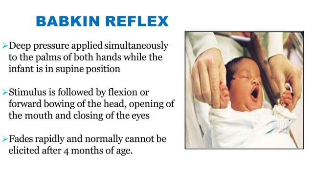 NEWBORN REFLEXES/ PRIMITIVE REFLEXES | PPTX