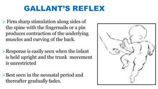 NEWBORN REFLEXES/ PRIMITIVE REFLEXES | PPTX