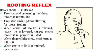 NEWBORN REFLEXES/ PRIMITIVE REFLEXES | PPTX