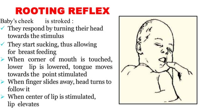 NEWBORN REFLEXES/ PRIMITIVE REFLEXES | PPTX