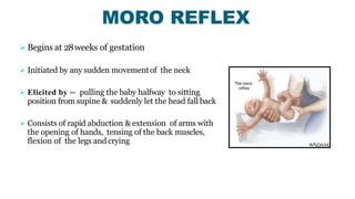 NEWBORN REFLEXES/ PRIMITIVE REFLEXES | PPTX